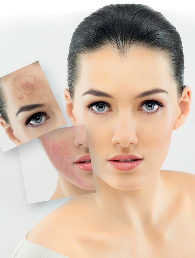 BALANCE SKIN RENEWAL TREATMENT | DRHAZI